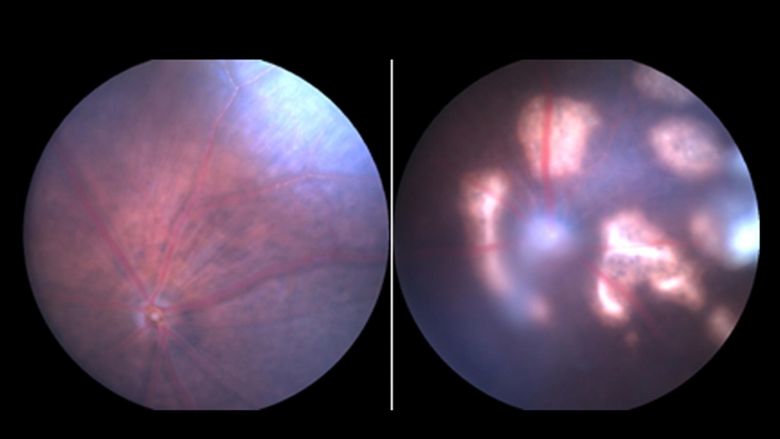 Singh Lab - University of Missouri School of Medicine